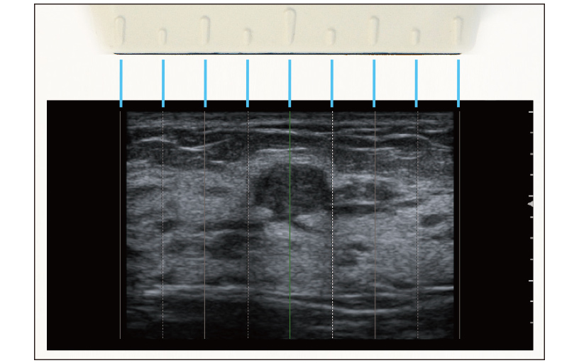 ARIETTA 65：Application | Fujifilm [Australia]