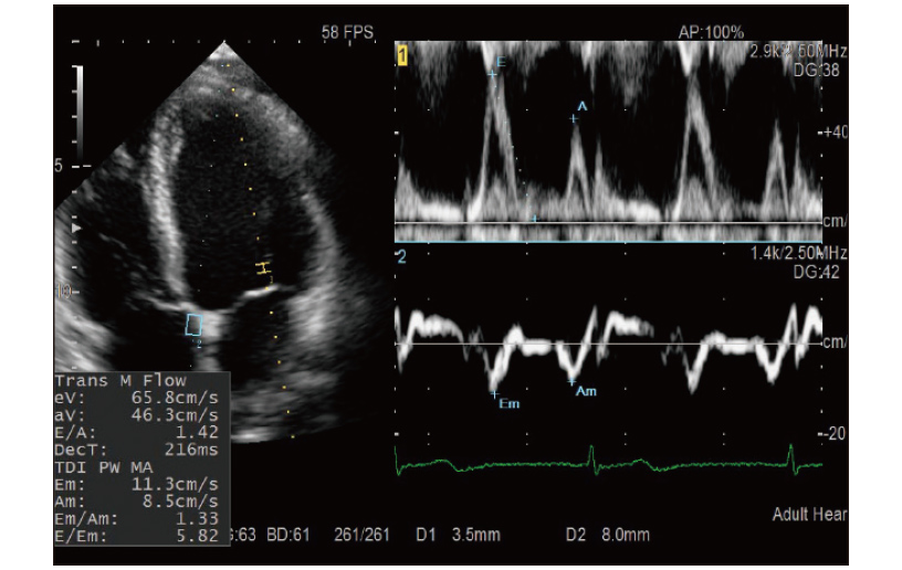 ARIETTA 65：Application | Fujifilm [Australia]