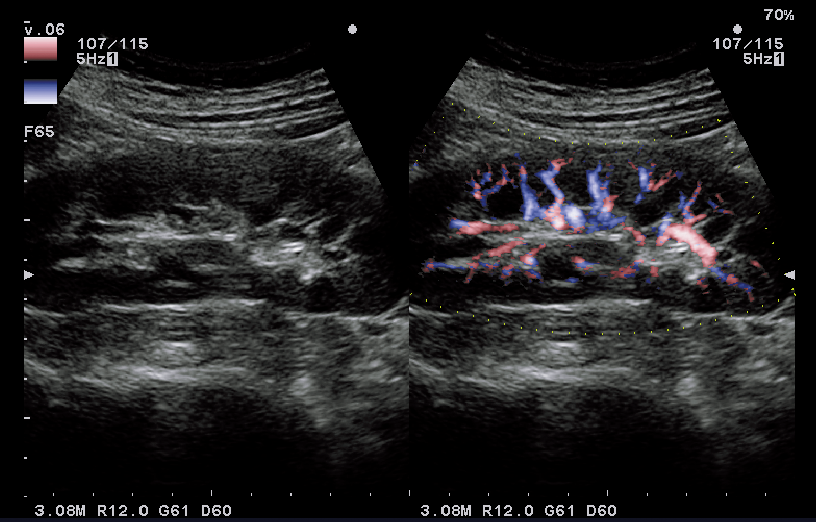 ARIETTA Precision：Advanced Features | Fujifilm [Australia]