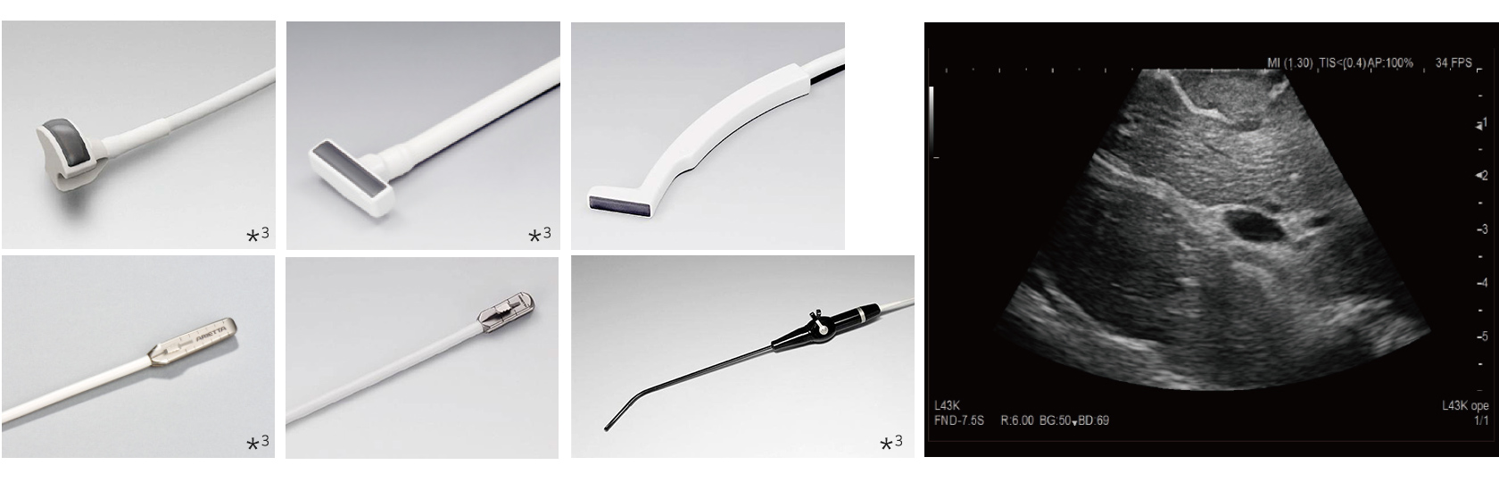 ARIETTA 65：Application | Fujifilm [Australia]