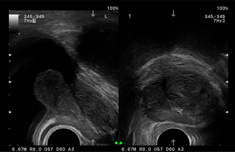 ARIETTA Precision：Advanced Features | Fujifilm [Australia]