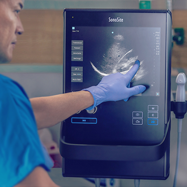 Bedside Ultrasound Machines