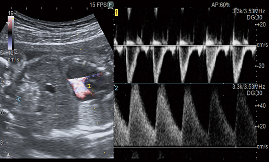 ARIETTA 850：Your Application | Fujifilm [Germany]