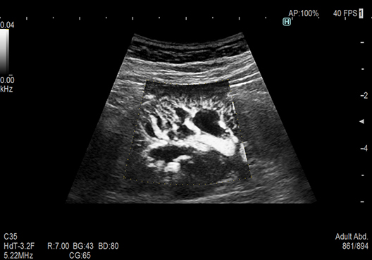 ARIETTA 850：Your Application | Fujifilm [Germany]