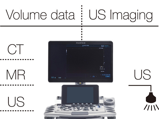 ARIETTA 850 : Votre application | Fujifilm [France]