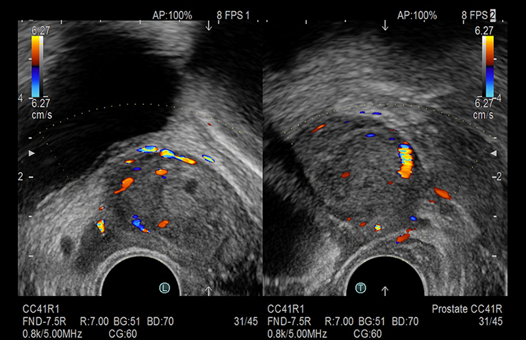 ARIETTA 65：Image Gallery | Fujifilm [India]