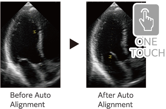ARIETTA 65：Application | Fujifilm [India]