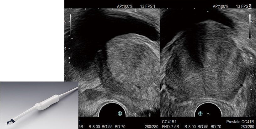 ARIETTA 65：Application | Fujifilm [Italy]