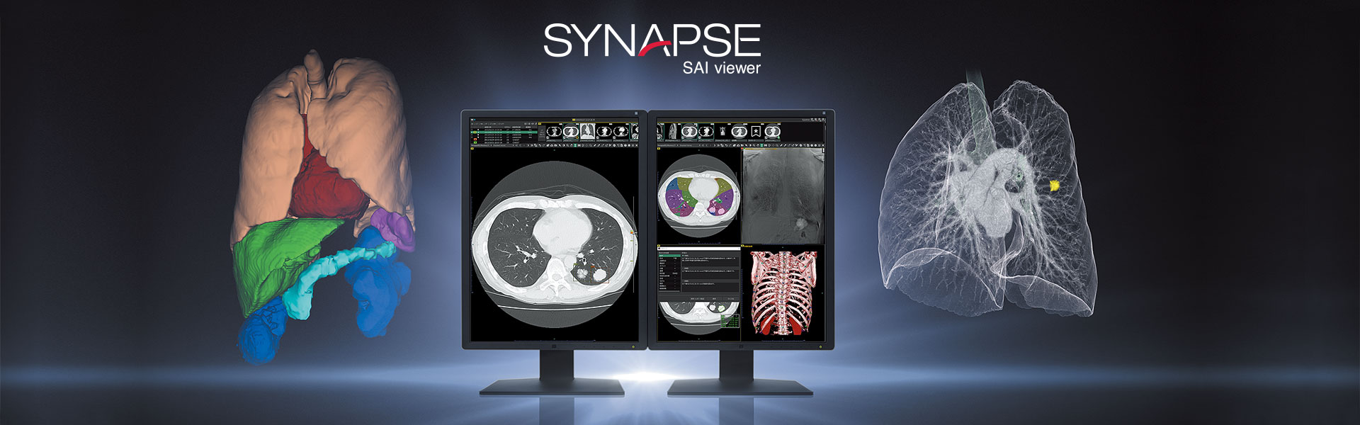 SYNAPSE SAI viewer | 富士フイルム [日本]