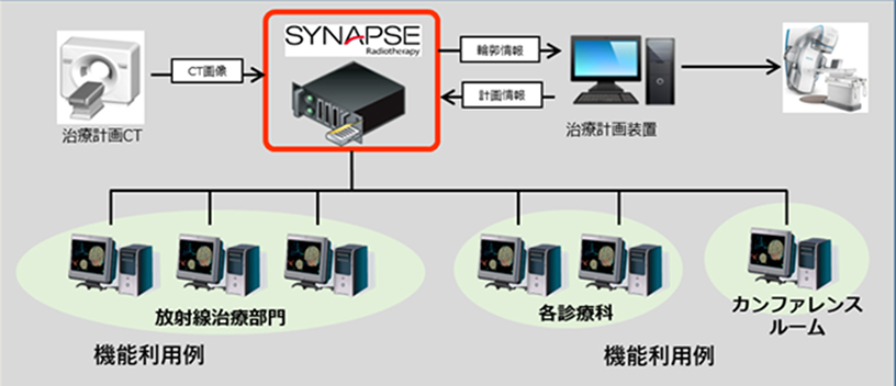 放射線治療計画支援ソフトウェア SYNAPSE Radiotherapy | 富士フイルム [日本]