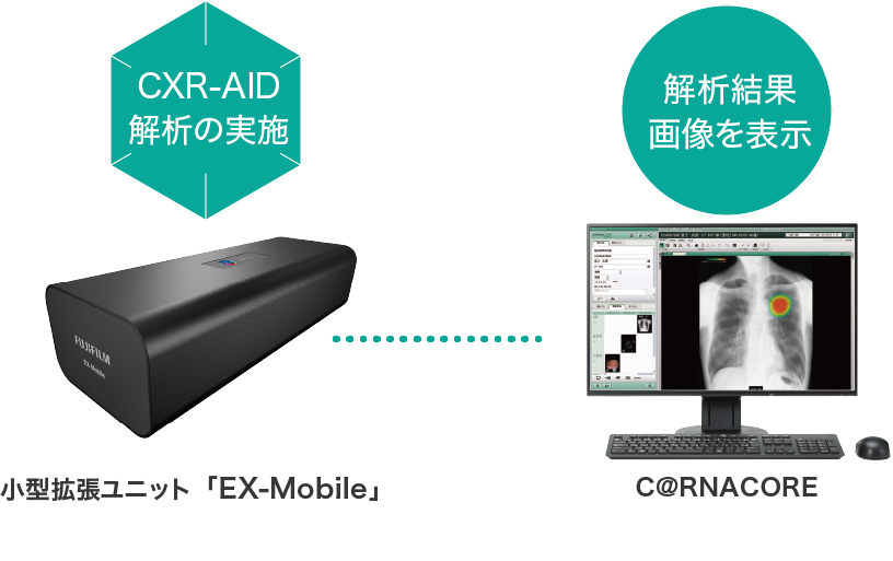 富士画像診断ワークステーション C@RNACORE：関連製品 | 富士フイルム [日本]