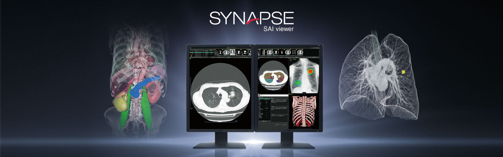 SYNAPSE SAI viewer | 富士フイルム [日本]