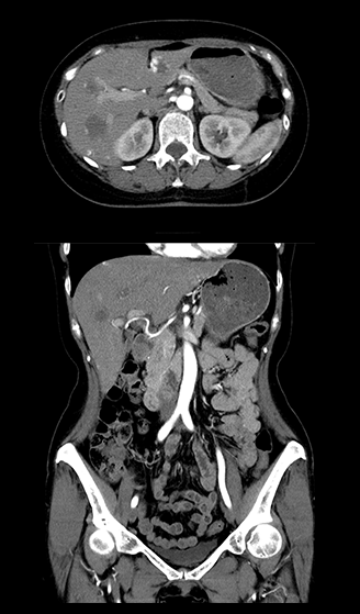 Supria Optica：イメージギャラリー | 富士フイルム [日本]