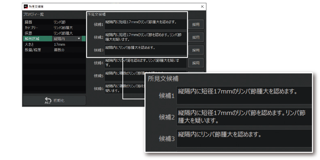 SYNAPSE SAI viewer：画像解析オプション | 富士フイルム [日本]