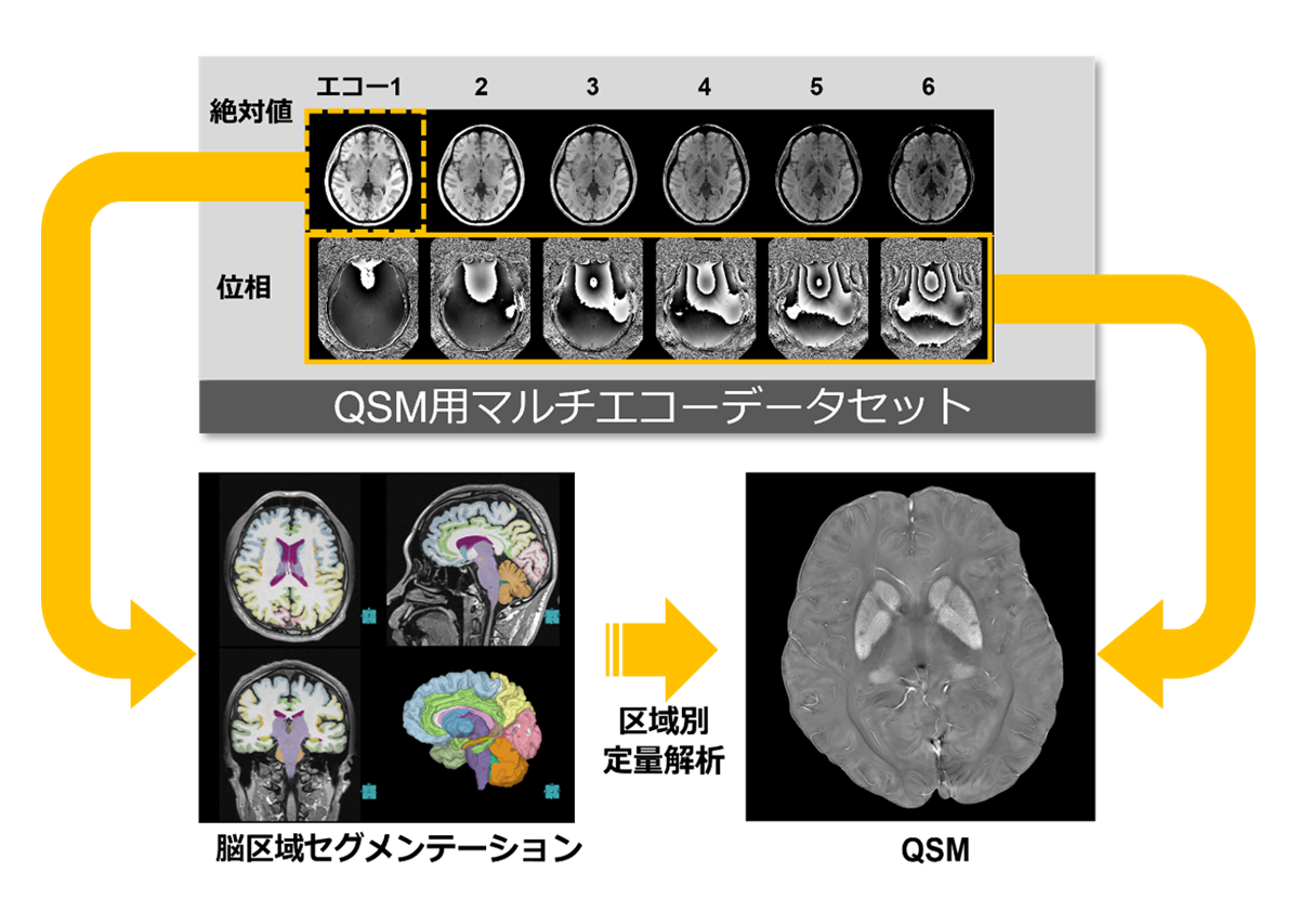 SYNAPSE VINCENT Core 技術・製品紹介 | 富士フイルム [日本]
