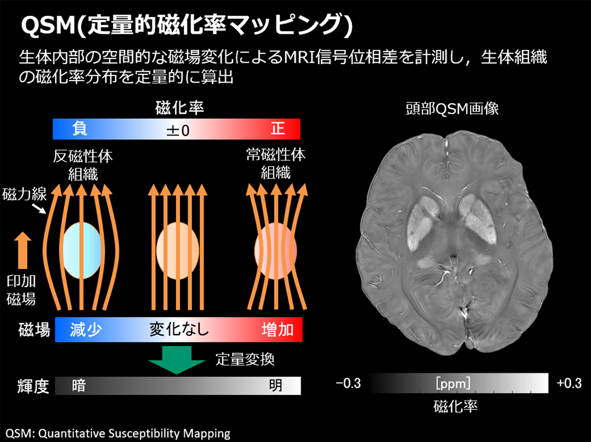 SYNAPSE VINCENT Core 技術・製品紹介 | 富士フイルム [日本]