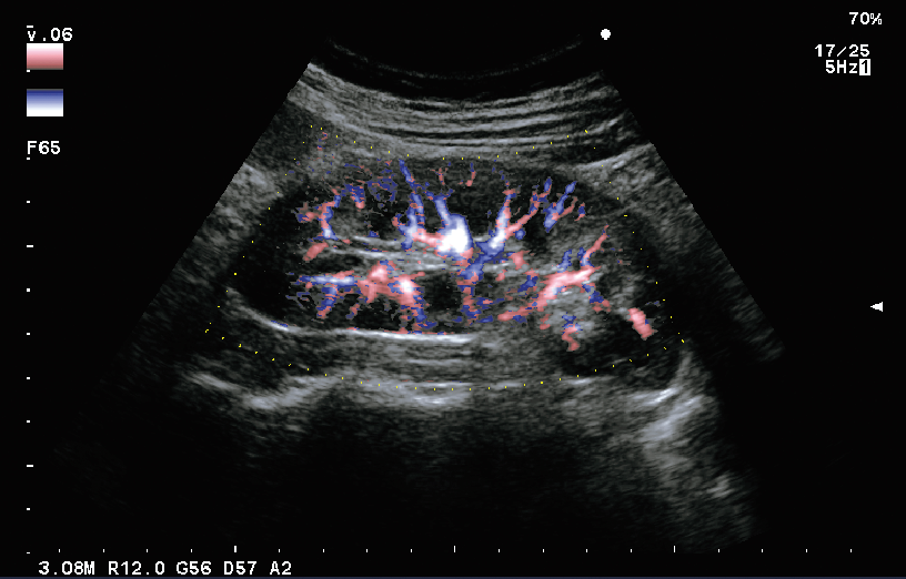 ARIETTA Precision：Advanced Features | Fujifilm [Myanmar]