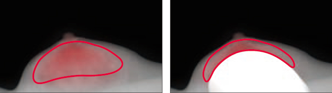 AMULET Innovality : Technology | Fujifilm [Mexico]