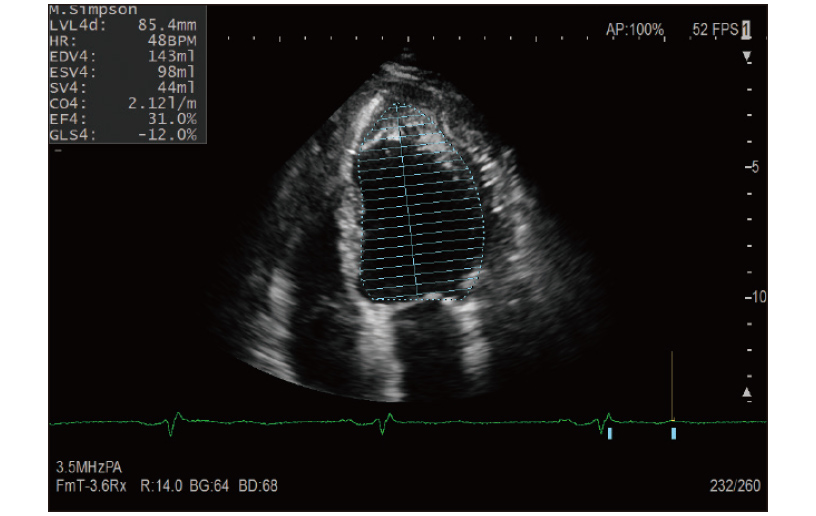 ARIETTA 65: Toepassing | Fujifilm [Nederland]