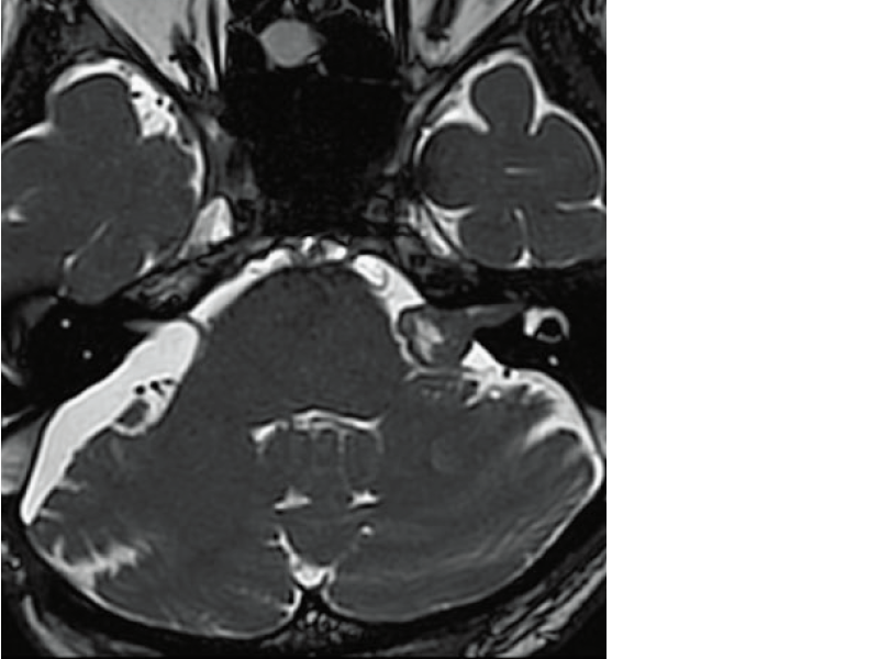 ECHELON Smart ZeroHelium：Image Gallery | Fujifilm [Peru]
