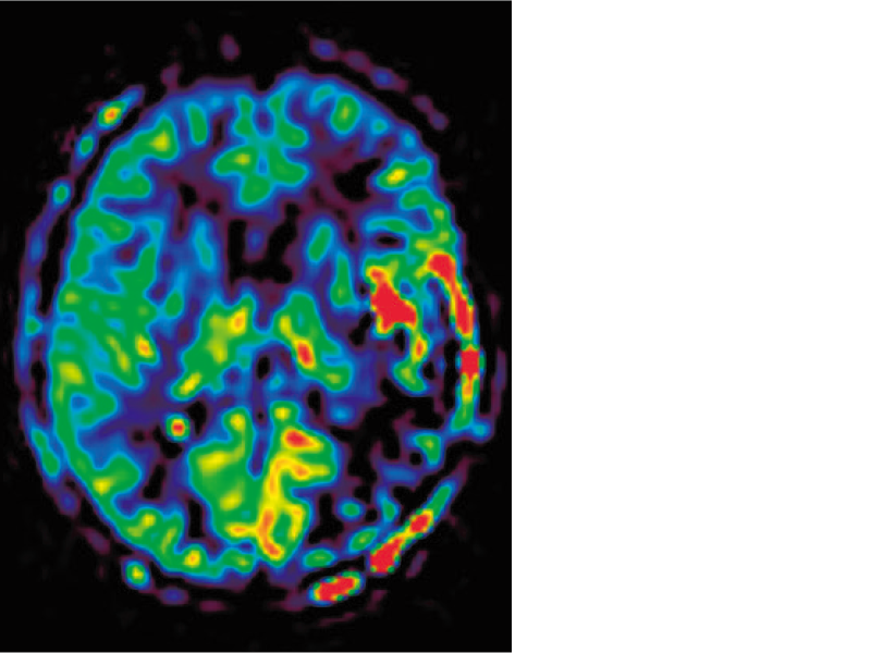 ECHELON Smart ZeroHelium：Image Gallery | Fujifilm [Peru]