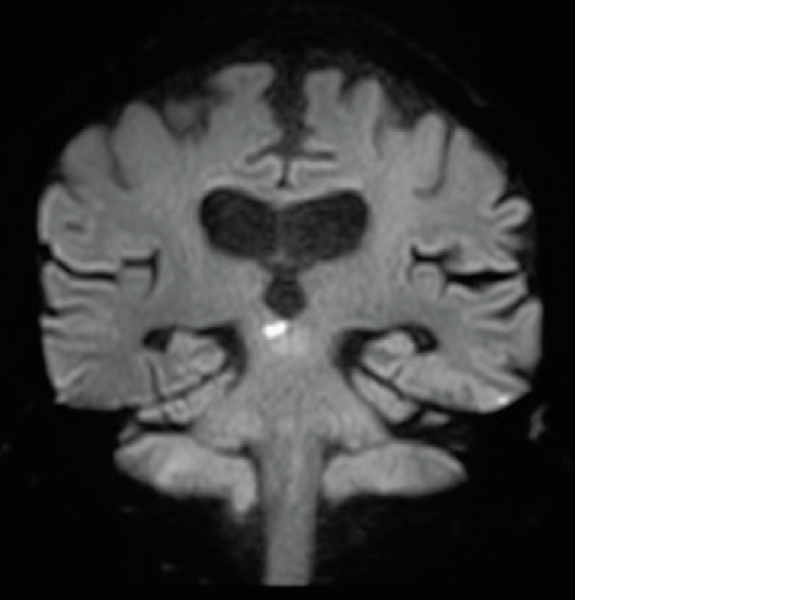 ECHELON Smart ZeroHelium：Image Gallery | Fujifilm [Peru]