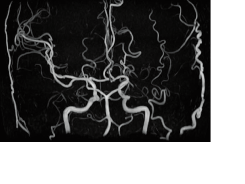 ECHELON Smart ZeroHelium：Image Gallery | Fujifilm [Peru]