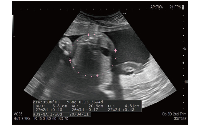 ARIETTA 65：Application | Fujifilm [Singapore]