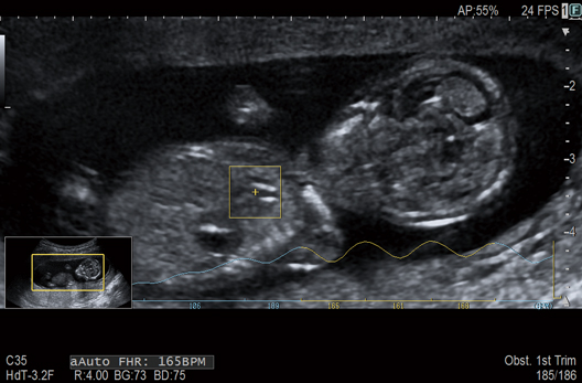 ARIETTA 850：Your Application | Fujifilm [Singapore]