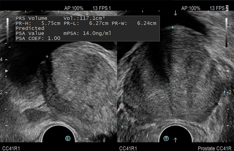 ARIETTA 65：Image Gallery | Fujifilm [Singapore]
