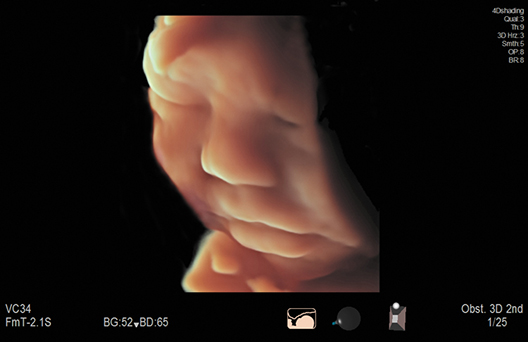 ARIETTA 850：Your Application | Fujifilm [Singapore]