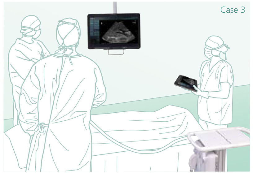 ARIETTA Precision：Versatility and Flexibility | Fujifilm [Singapore]