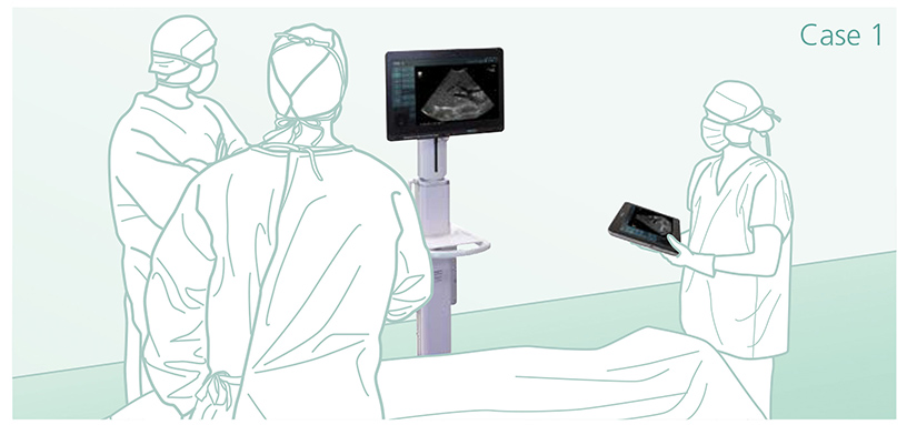 ARIETTA Precision：Versatility and Flexibility | Fujifilm [Singapore]