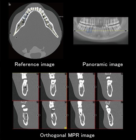 Dental Analysis | Fujifilm [Singapore]