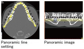 Dental Analysis | Fujifilm [Singapore]