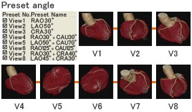 Coronary Analysis | Fujifilm [Singapore]