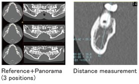 Dental Analysis | Fujifilm [Singapore]