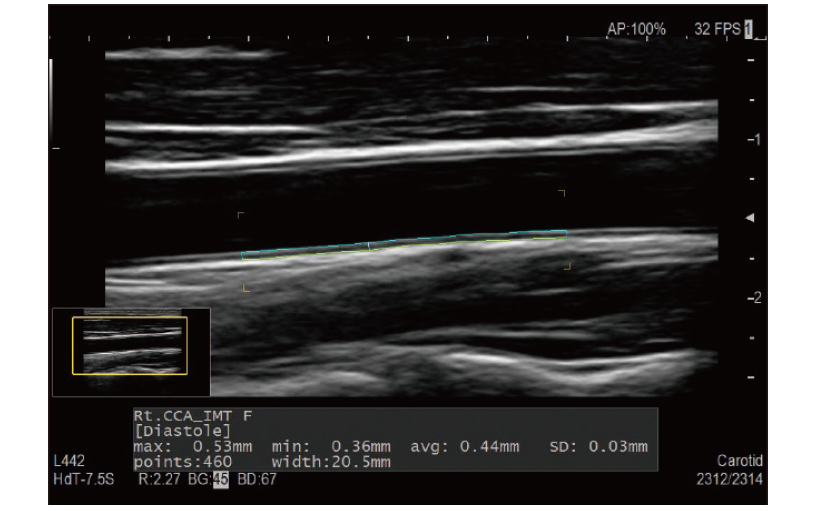 ARIETTA 65：Application | Fujifilm [United Kingdom]