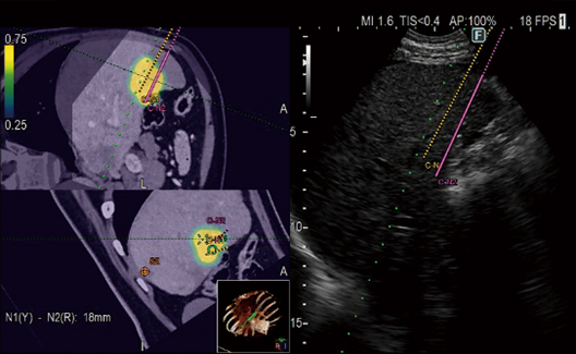 ARIETTA 850：Your Application | Fujifilm [United Kingdom]