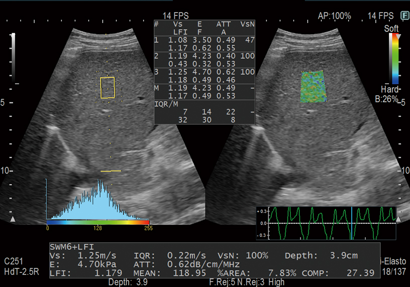 ARIETTA 850：Your Application | Fujifilm [United Kingdom]
