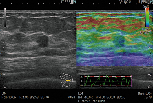 ARIETTA 850：Your Application | Fujifilm [United Kingdom]