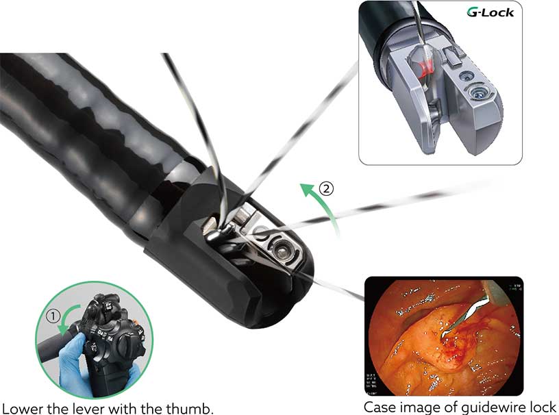 Duodenoscopes | Fujifilm [Vietnam]